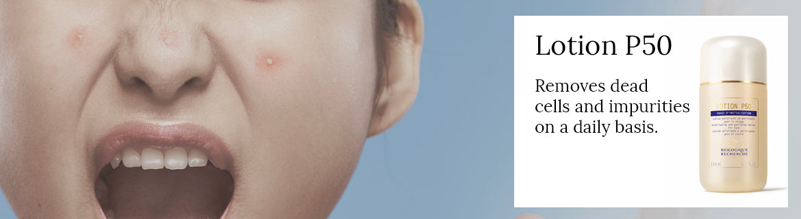 Skin Type/Acne-treatments – KarinaNYC