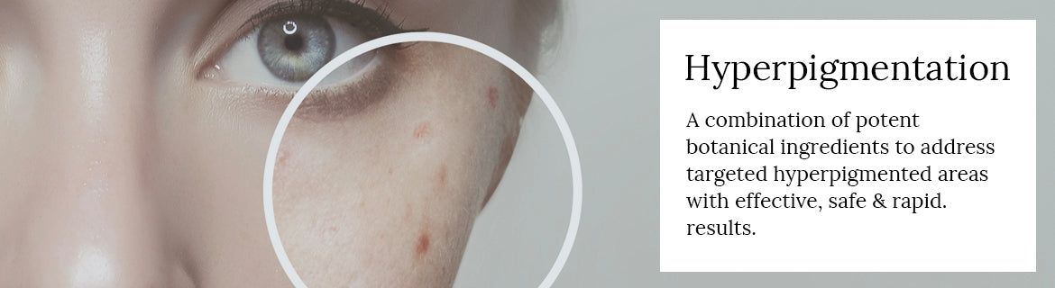 Hyperpigmentation Best Selling Products & Free Shipping – KarinaNYC